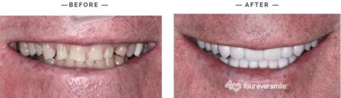 Patient Reviews - Four Ever Smile™